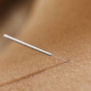 Diji SP8: Nomenclature, Location, Function, Indication - Acupuncture Nepal