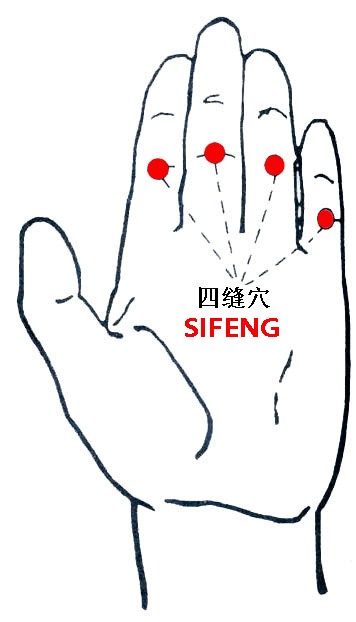 Sifeng EX-UE10 : Location, Functions, Indication, Method - Acupuncture ...